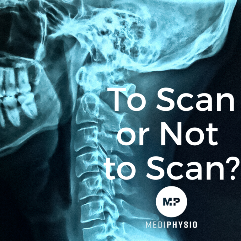 Do I need a scan? To scan or not to scan? - MediPhysio